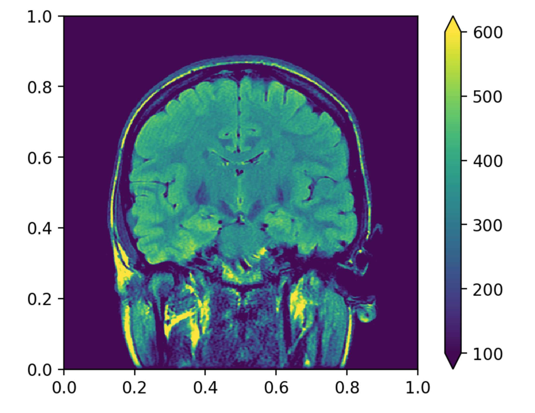Lecture 14.2 -- Scientific Visualization (for Quiz and EC)